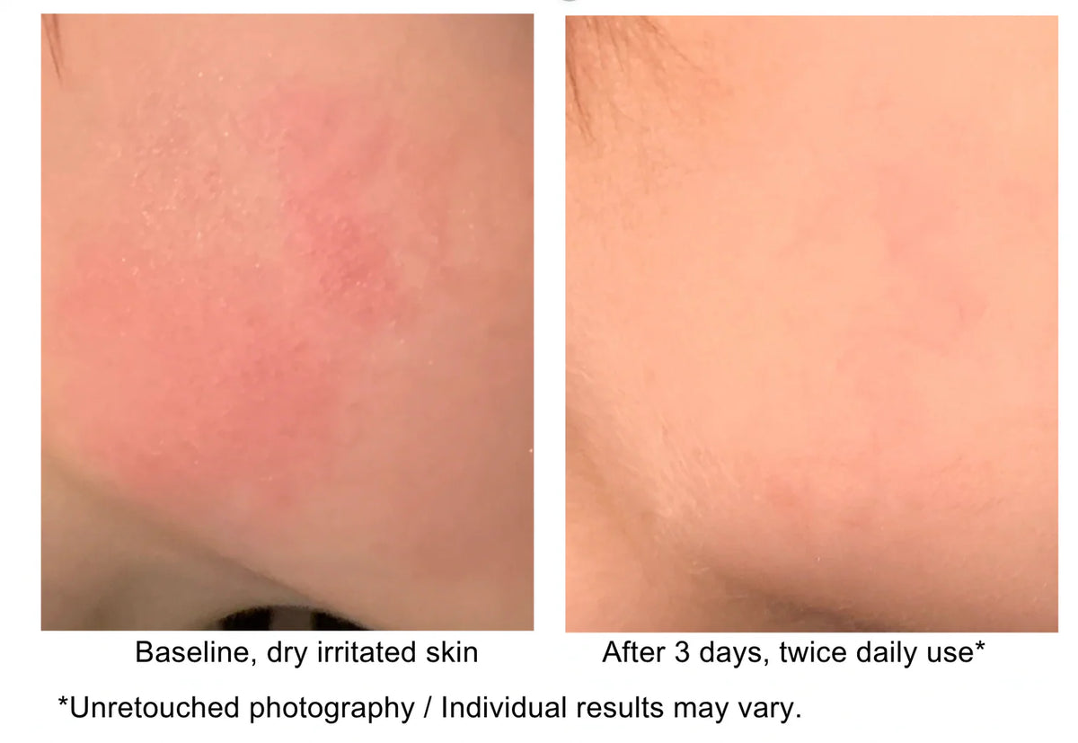 THOYA Nutrient Oil Canada | Lightweight Hydrating Skin Oil for ...