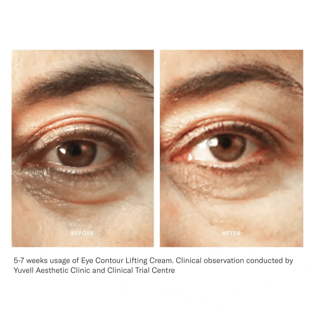 Calecim Pro Eye Contour Lifting Cream – SMUKKE HOUSE